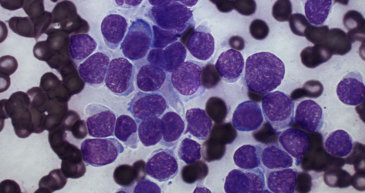 Dermatološka sekcija SZVMŽ: Cytological evaluation of inflammatory and ...