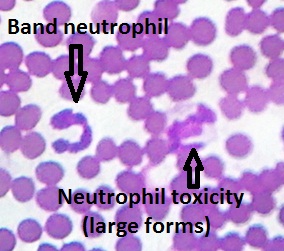 VeteriSilvia: Immune mediated polyarthritis in a dog/poliartritis ...