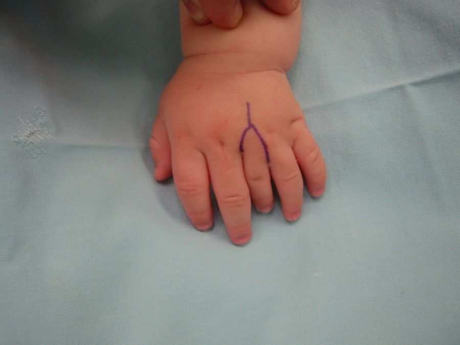 Sobre técnicas de imágenes médicas (Blog STIM): abril 2011