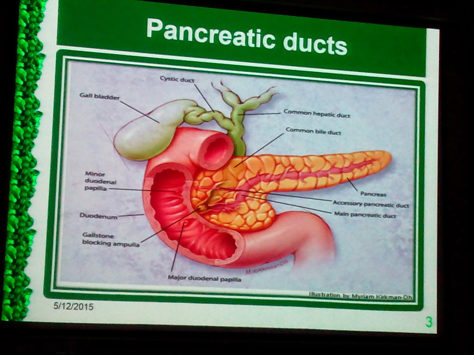 Lecture Slides; Surgery; Acute Pancreatitis