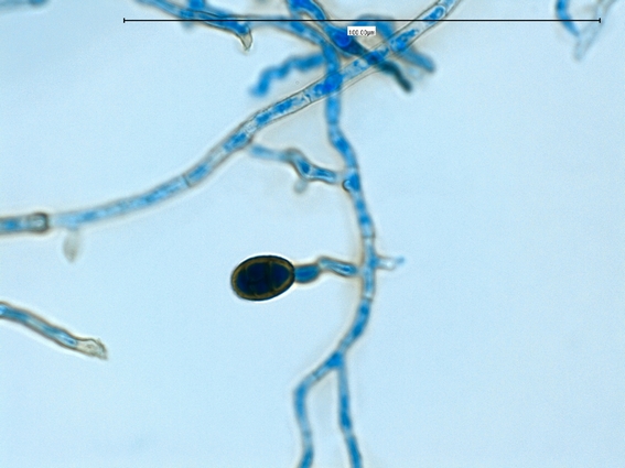 Fun With Microbiology (What's Buggin' You?): Pithomyces species