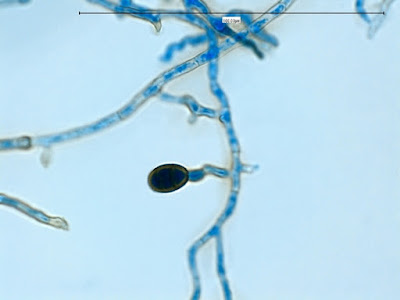 Fun With Microbiology (What's Buggin' You?): Pithomyces species