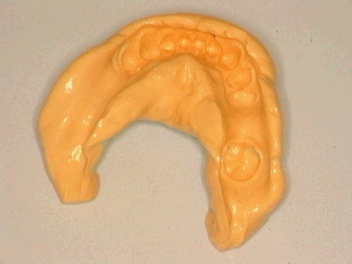 Dentistry and Medicine: Elastic Impression Materials-Hydrocolloids ...