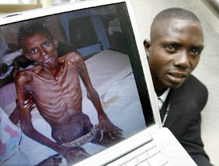 el sida: IMÁGENES DE EL SIDA