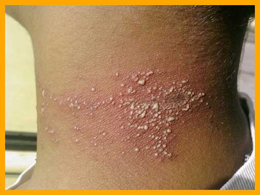 Gambar Foto Hewan: foto luka akibat tomcat