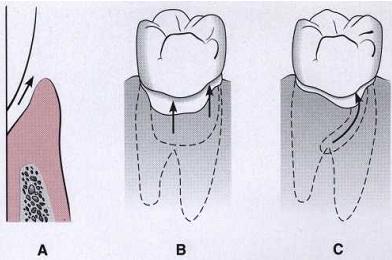 Dentistry lectures for MFDS/MJDF/NBDE/ORE: A NOTE ON CLASSIFICATION ...