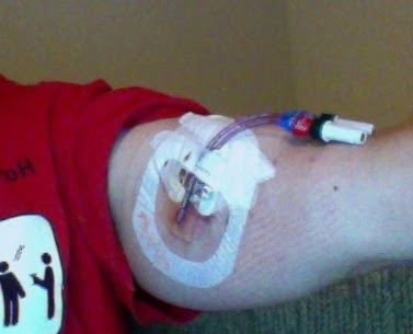 Thrilled to Death: Paul Pavao's Leukemia Blog: PICC Lines and Platelets