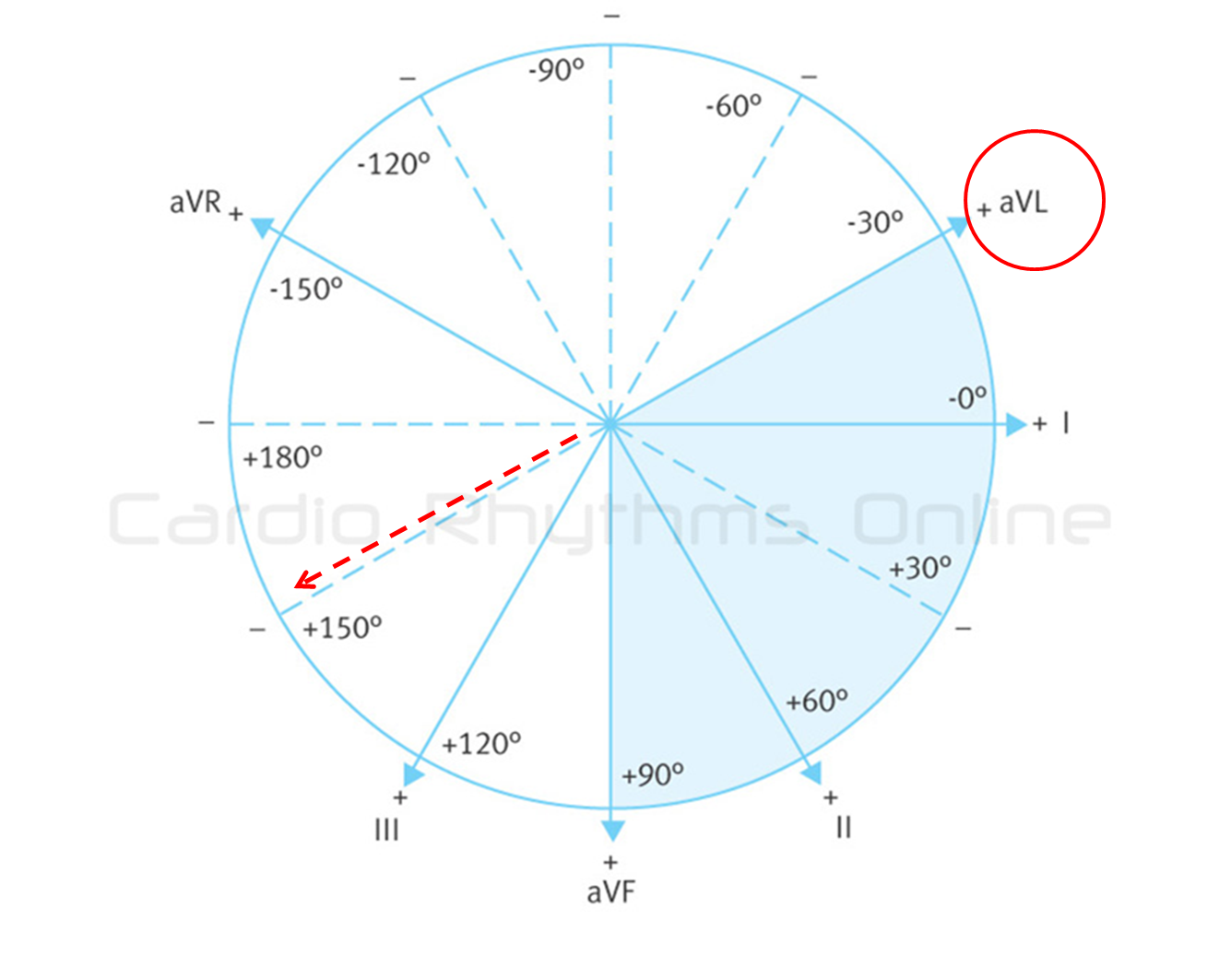 CVT Mohd Farid: ECG Basic:Cardiac Axis-Credit Cardio Rhythm Online Blogspot