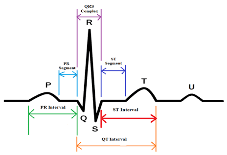 ECG