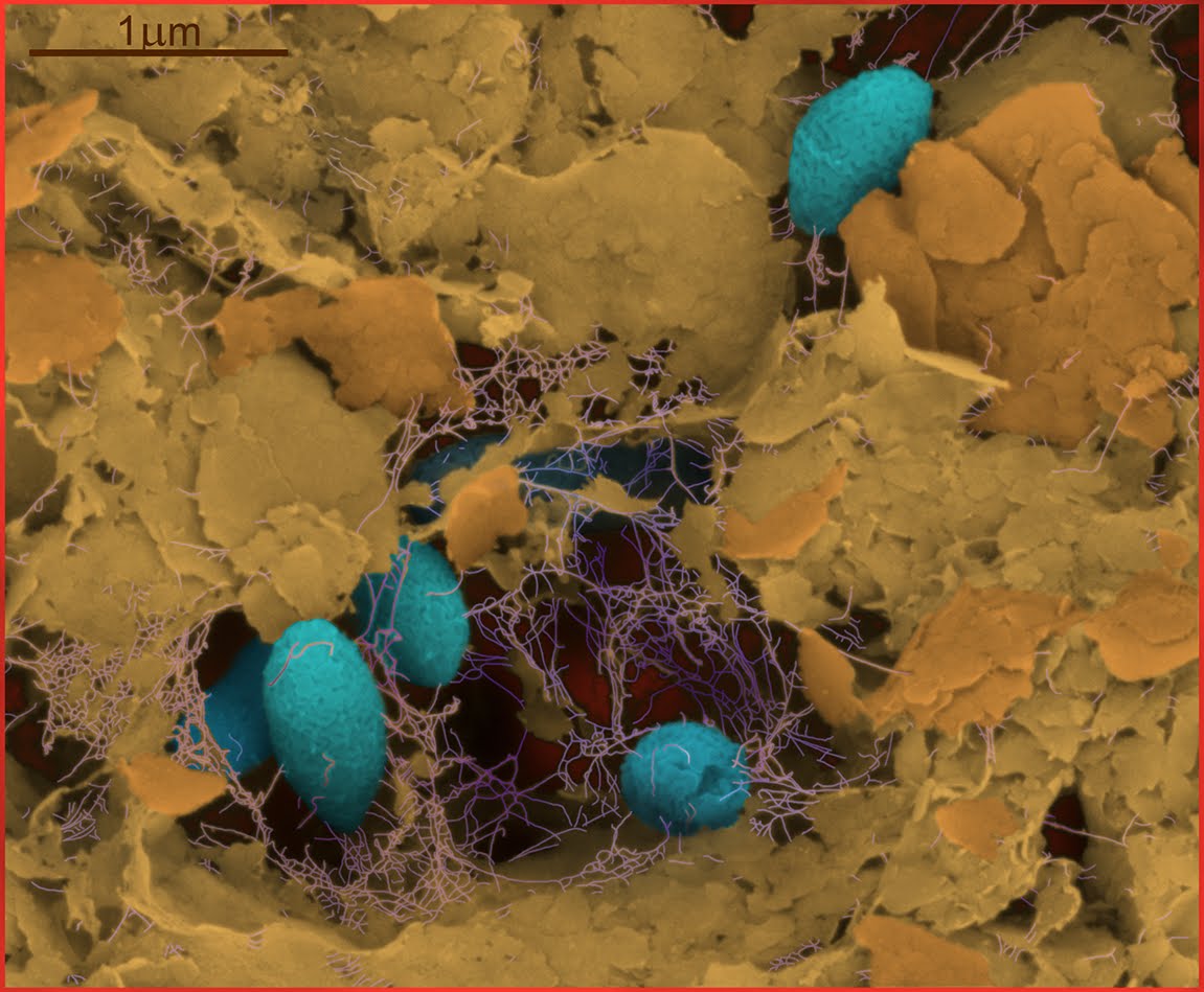 Of Bacteria and Men: A view of microbial life in soil
