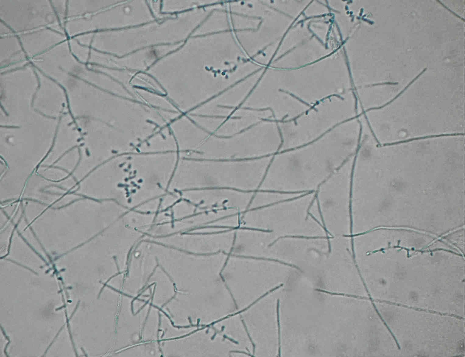 ATLAS MICOLOGIA: TRICHOPHYTON TONSURANS (2)