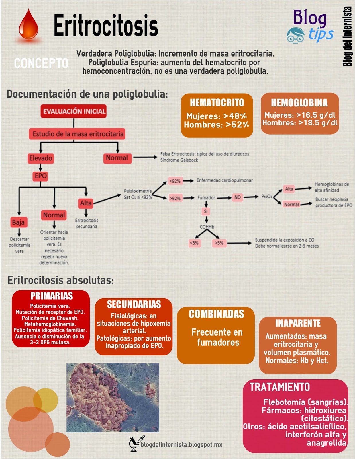 Blog del Internista: #BlogTips - Infographics