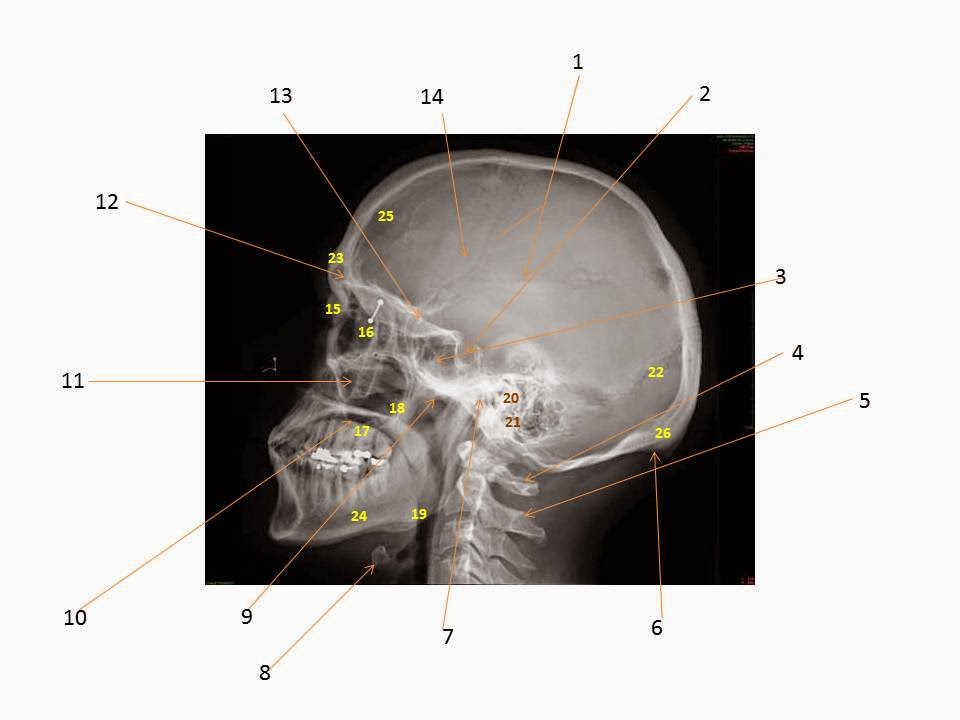 E-Anatomía Odontológica: grupo A3 RX PA de craneo y Rx LATERAL de craneo