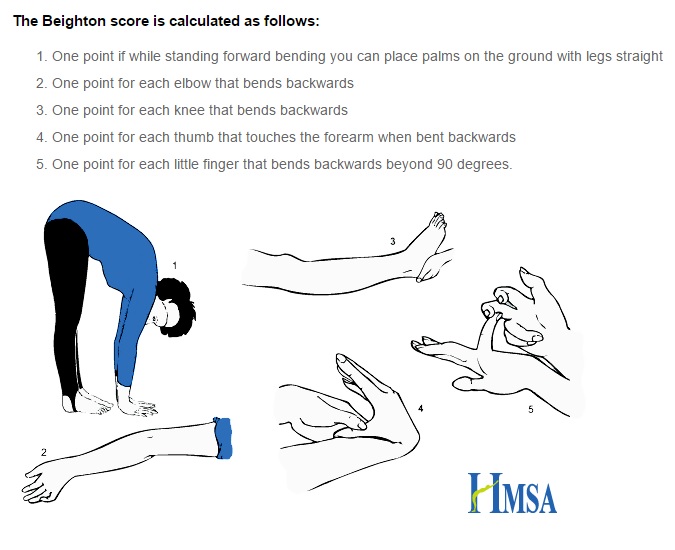 Just a Girl with a Blog: Living with Joint Hypermobility