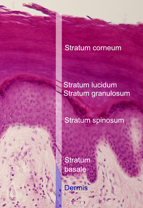 Stratum corneum layer in skin - Function of stratum corneum cells | the ...