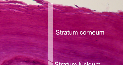 Stratum corneum layer in skin - Function of stratum corneum cells | the ...