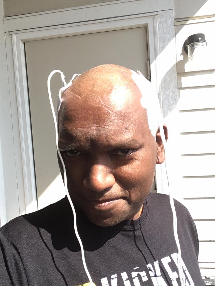 My journey with Glioblastoma - Prakash Murthy: I like being alive. So I ...