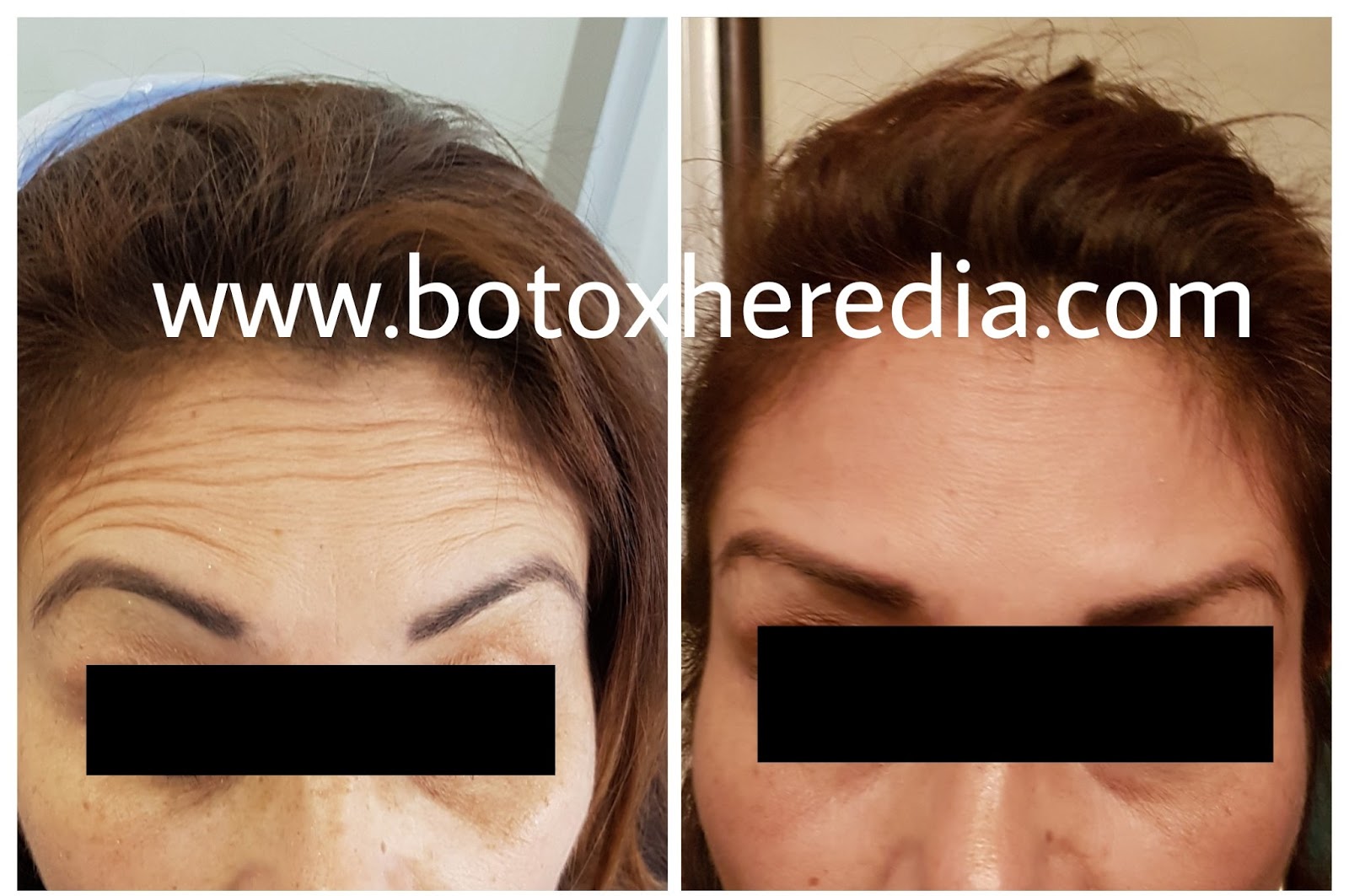 Cirujano Oral, Estética y Armonización