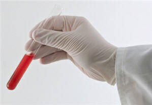 Biochemistry Class notes: Thyroid profile testing or Thyroid function ...