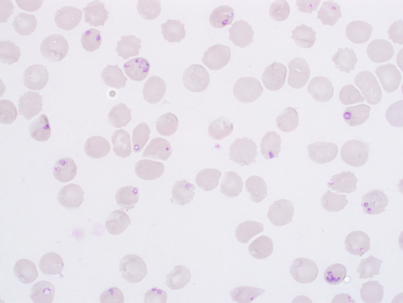 Creepy Dreadful Wonderful Parasites: Case 250