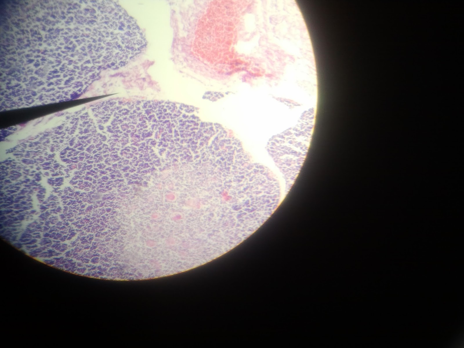 HISTOLOGIA: TEJIDOS LINFÁTICOS