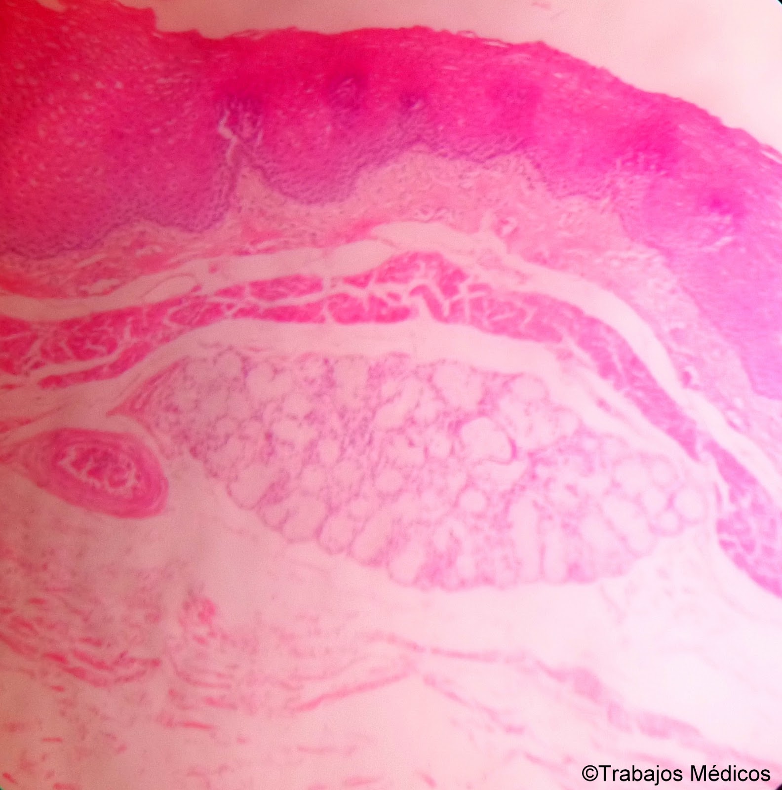 ESÓFAGO - PLACAS HISTOLÓGICAS