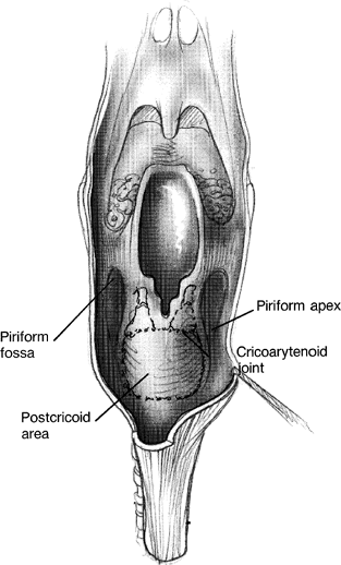 Postcricoid Area or Region