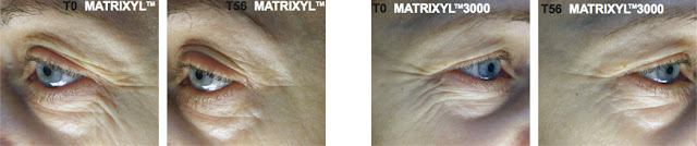 Argireline: Dr Oz's Botox alternative: Argireline Eye Cream on Dr Oz Show