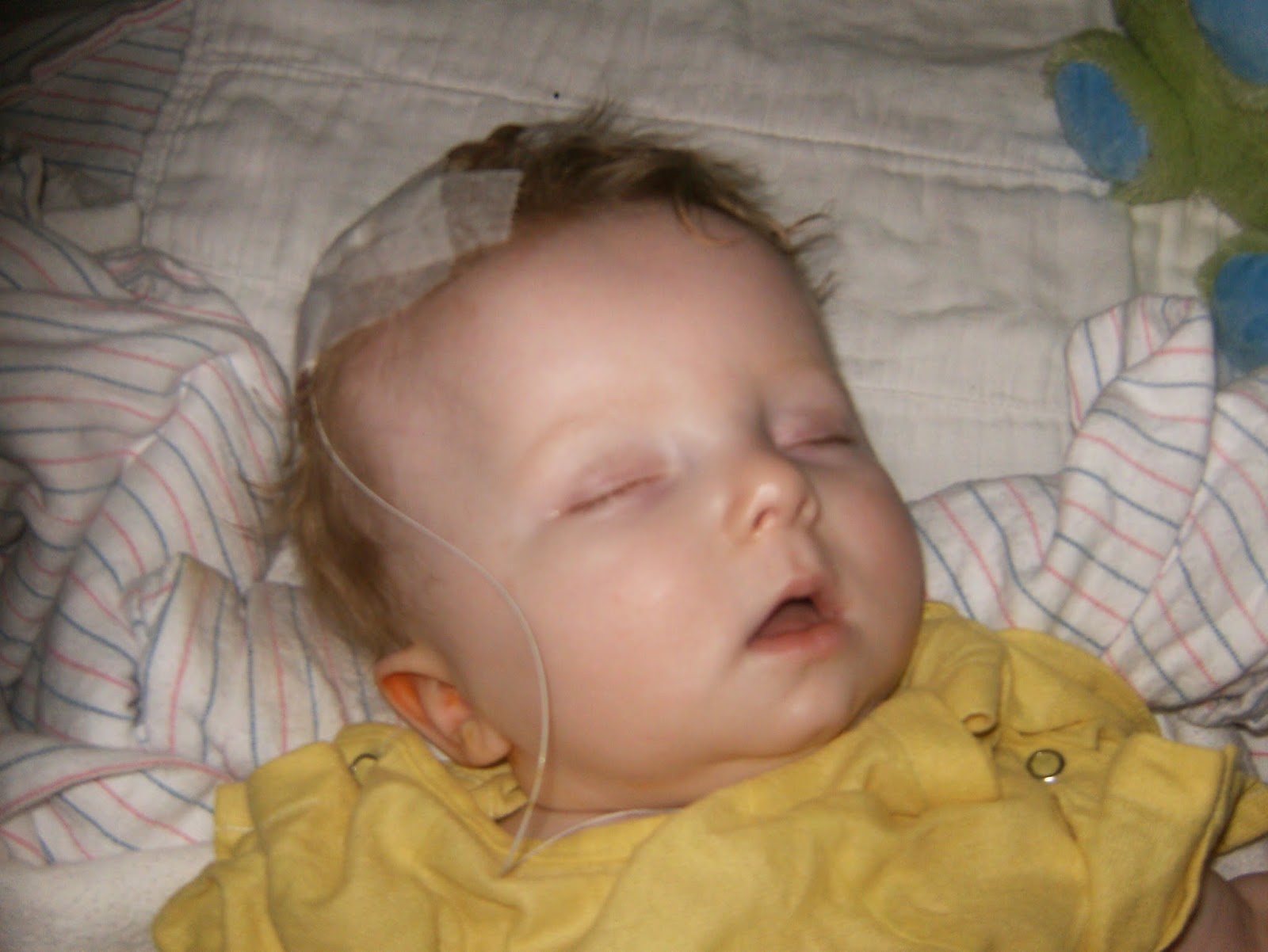 Hydro hero: Hydrocephalus Awareness Month Day 2