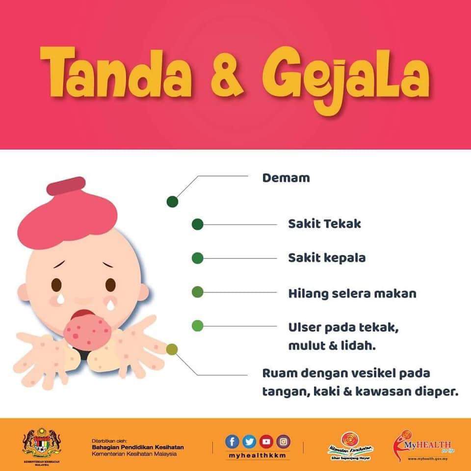 Kenali Penyakit Tangan Kaki Dan Mulut Serta Nasihat Kepada Ibu Bapa ...