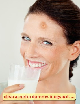 The Unexplored Milk As Well As Acne Relation - Beauty Women's
