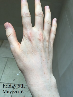 Hand-some | TSW Cara