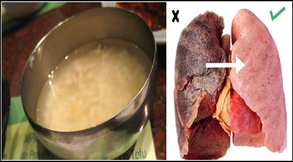 Pentru Suflet: Daca sunteti fumator de cel putin 5 ani, aceasta reteta ...