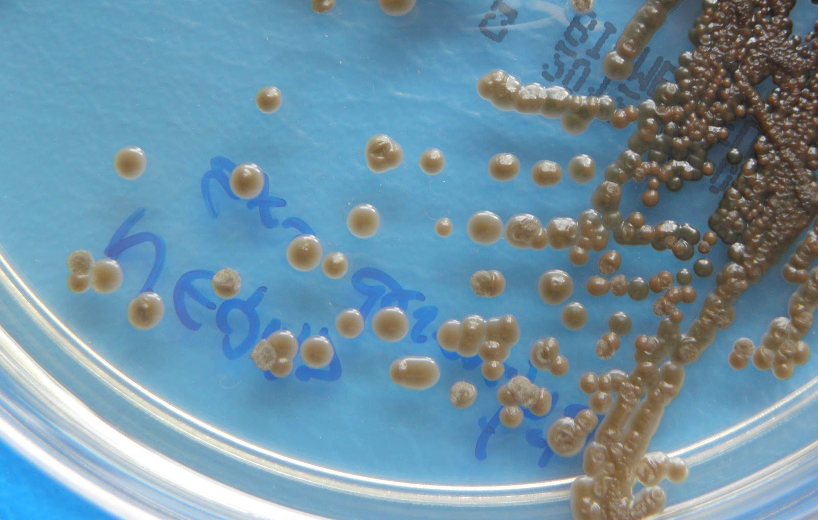 ATLAS MICOLOGIA: EXOPHIALA DERMATITIDIS