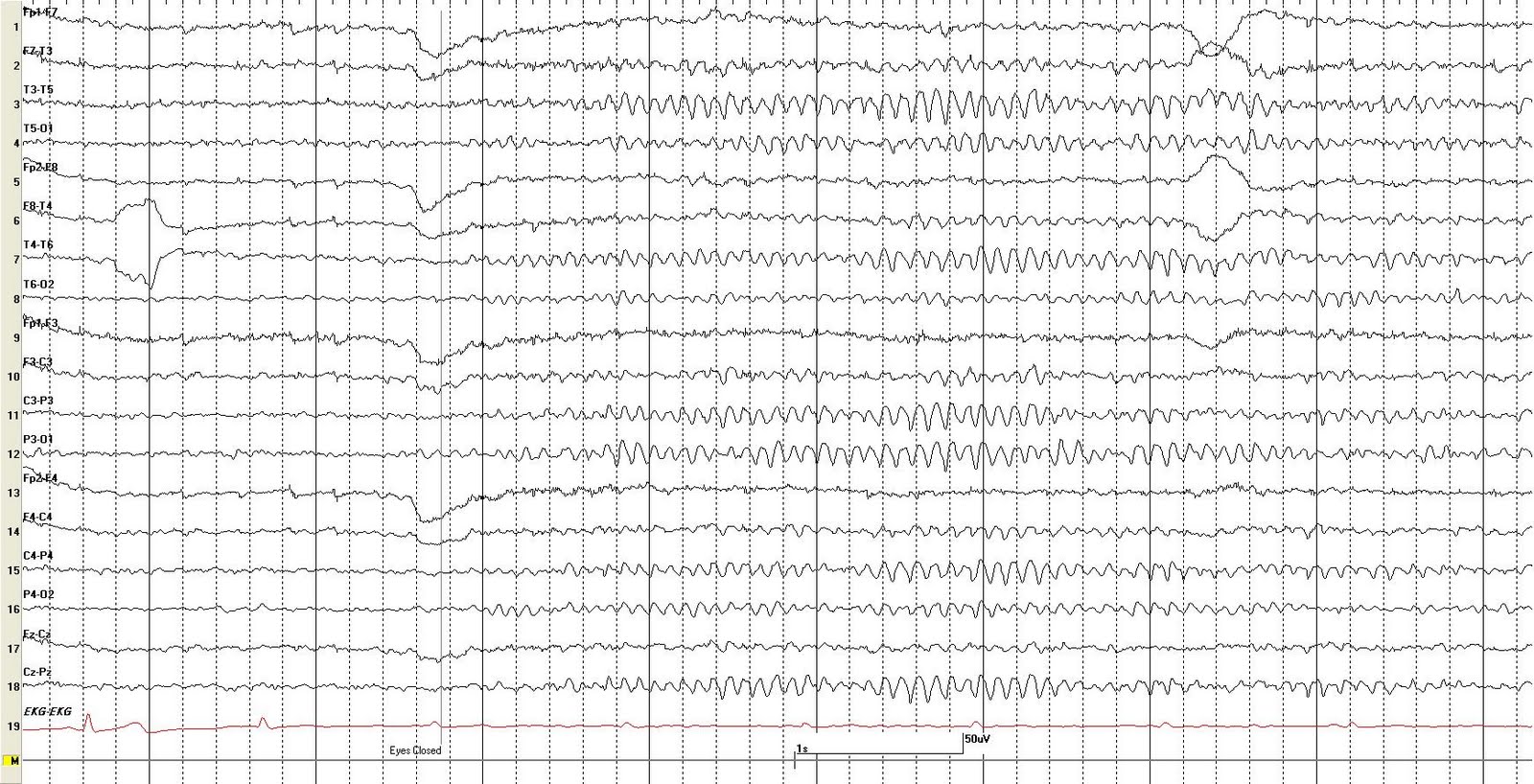 EEG Reviewer: EEG No. 3