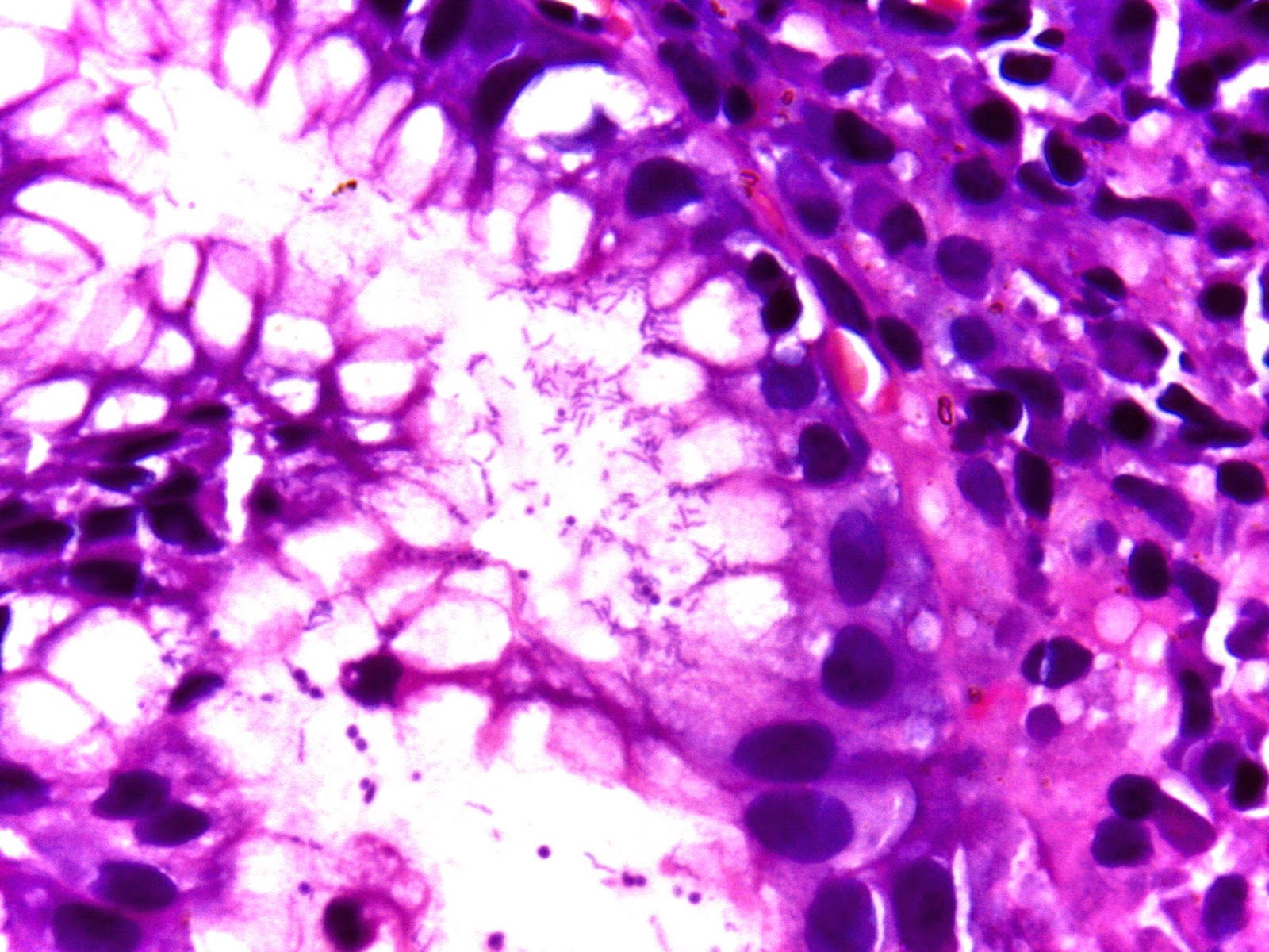 GASTROINTESTINAL AND LIVER HISTOLOGY PATHOLOGY ATLAS: STOMACH: ANOTHER ...