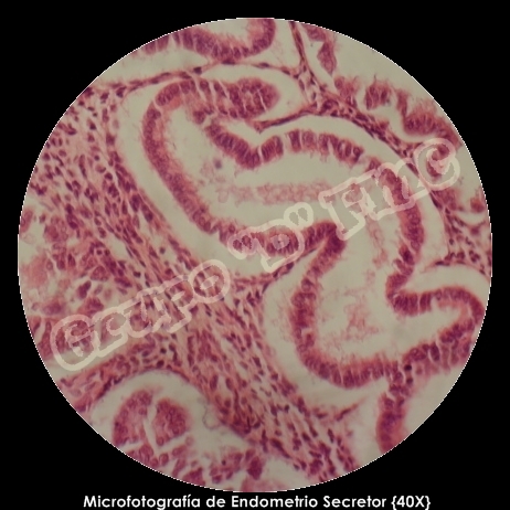 Histologeando: ENDOMETRIO
