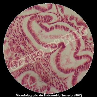 Histologeando: ENDOMETRIO