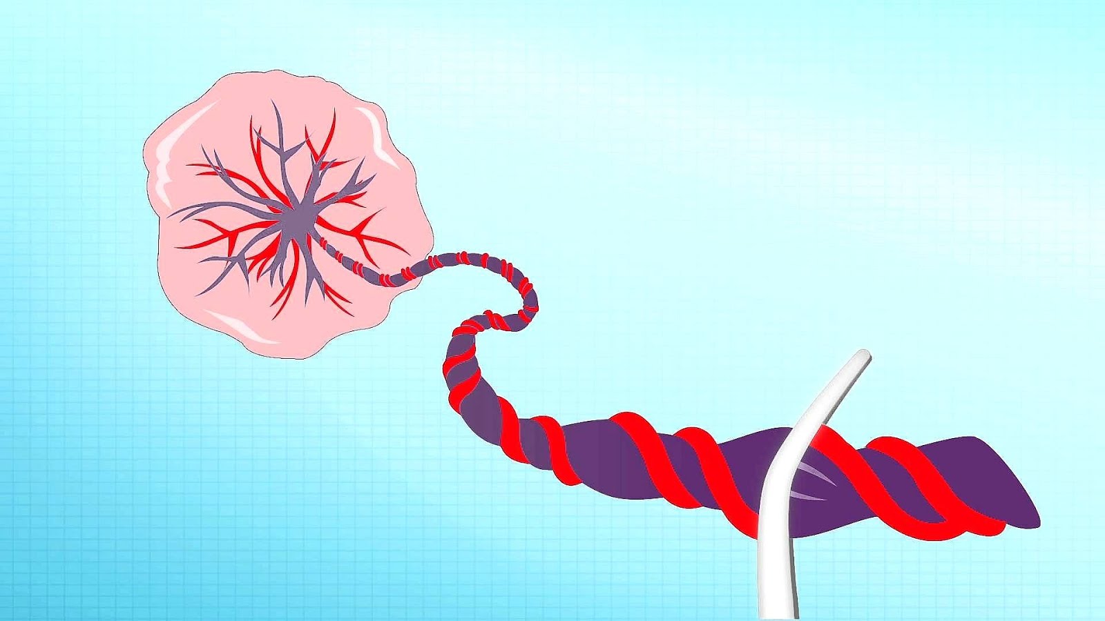 Umbilical Cord Blood Collection - Collect Choices