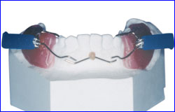 FABRICAR LA APARATOLOGÍA UTILIZANDO DIVERSAS TÉCNICAS Y MATERIALES ...