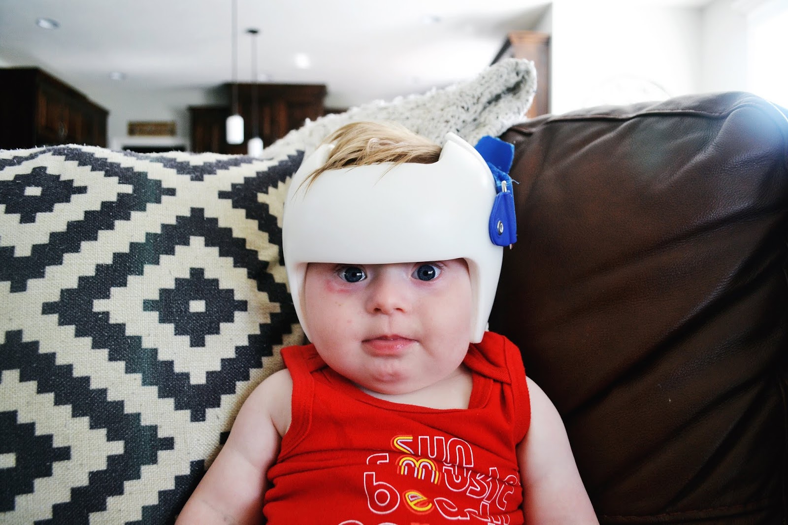 Diagnosis :: Infantile Spasms