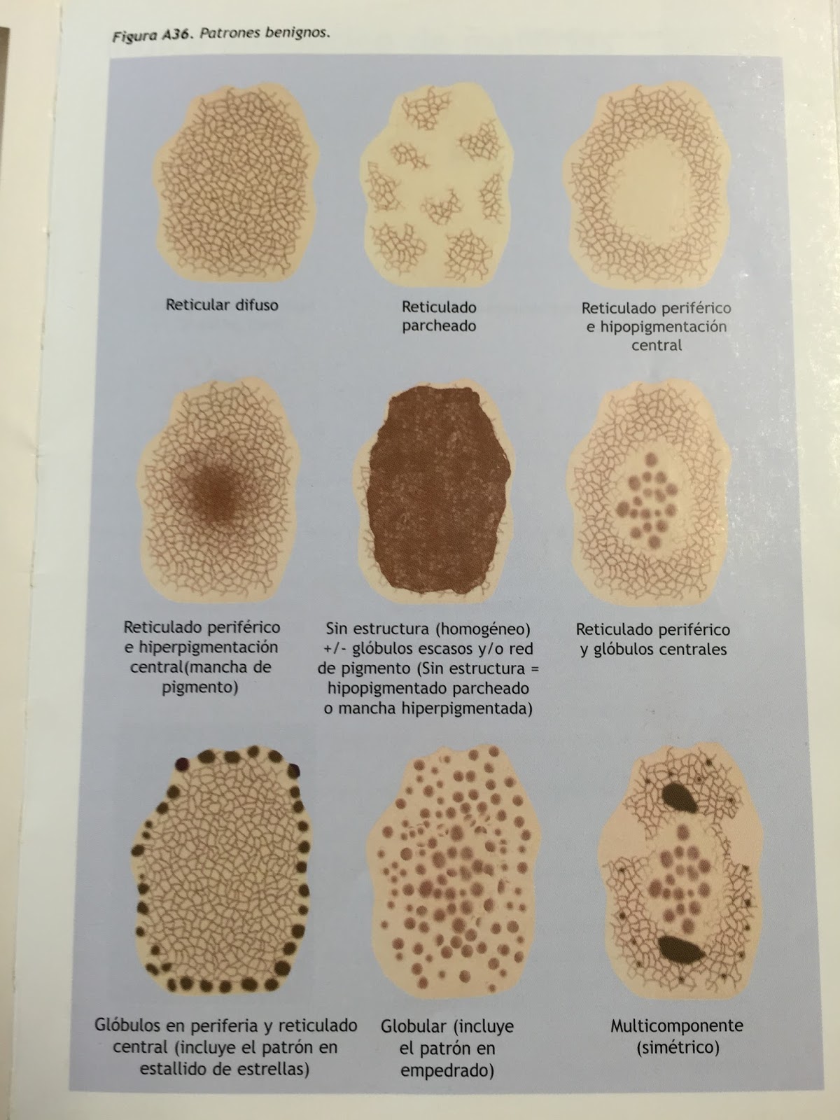 El rincón del resi MIR: ROTATORIO DERMATOLOGÍA