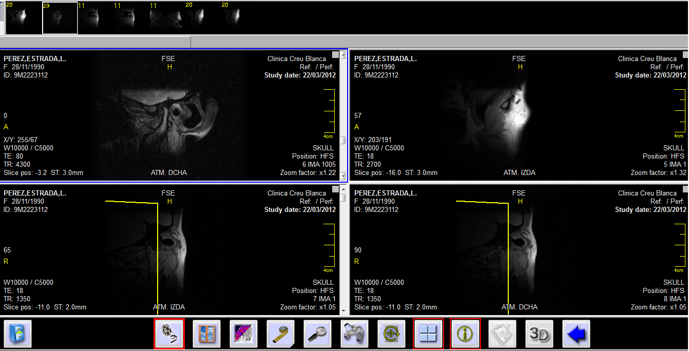 Dentistry: Magnetic resonance imaging of TMJ