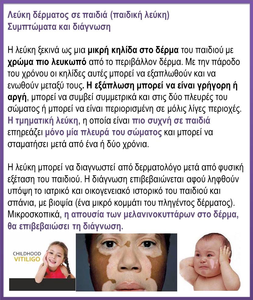 PEDIAMED: Τι είναι η ΄΄Λεύκη ΄΄ και η ''Παιδική Λεύκη '' και πως ...