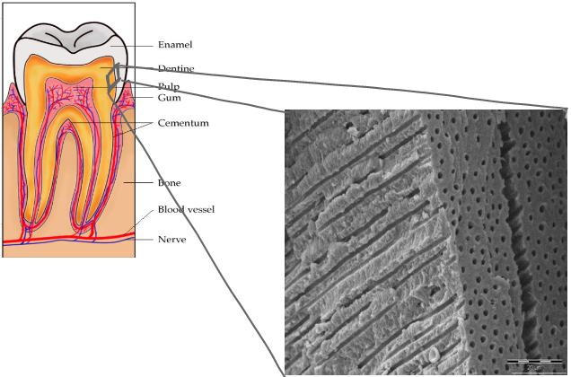 modern dentistry: let's talk about tooth colored fillings...