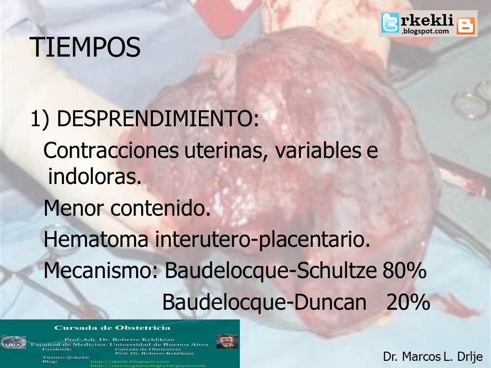 Cursada de Obstetricia Hospital Rivadavia UBA: Alumbramiento