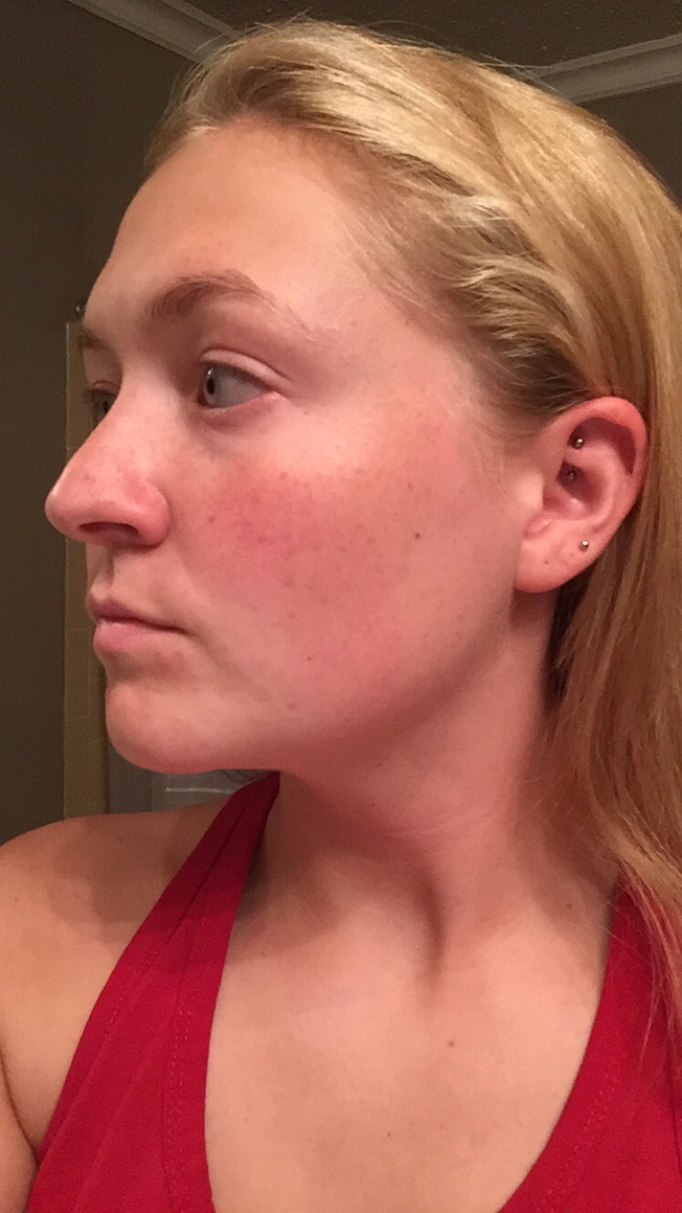 Shayne Walker: I Washed My Face with Coconut Oil for a Week