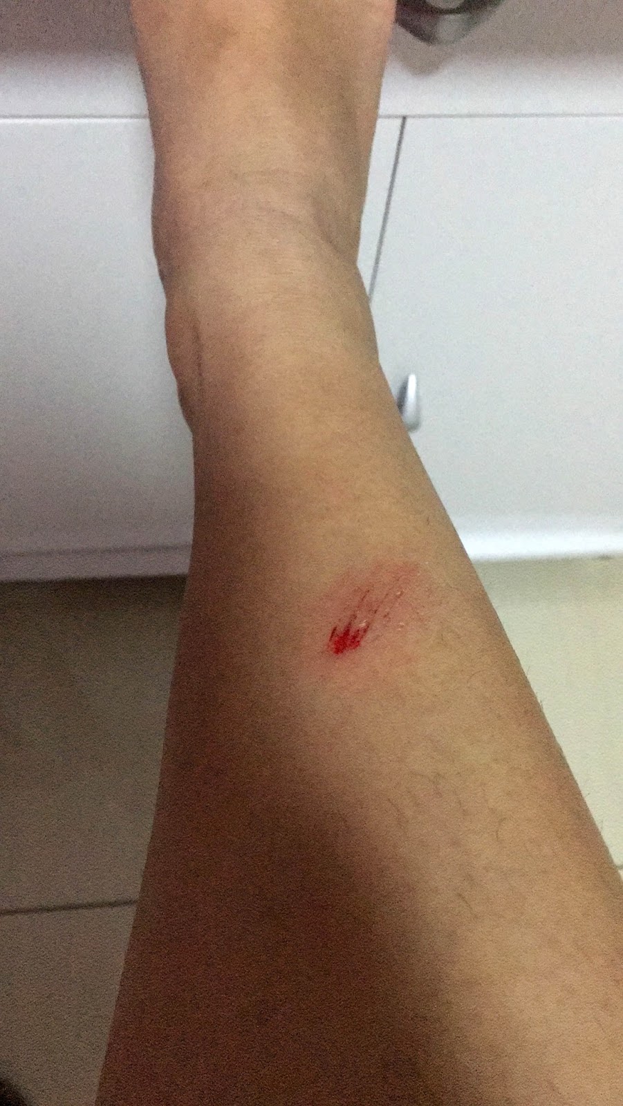 Machucados em diabéticos - SOU DOCE ROSEMARY