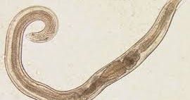 Universo Microbiológico: Enterobius vermicularis