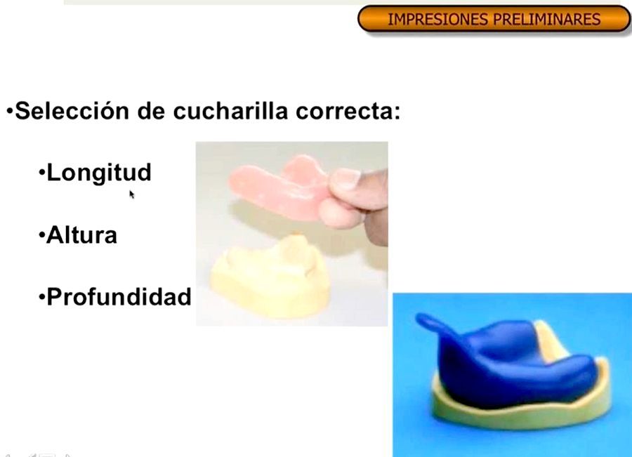 VIDEOCONFERENCIA: Prótesis totales exitosas - C.D. Alejandro Quiroz ...